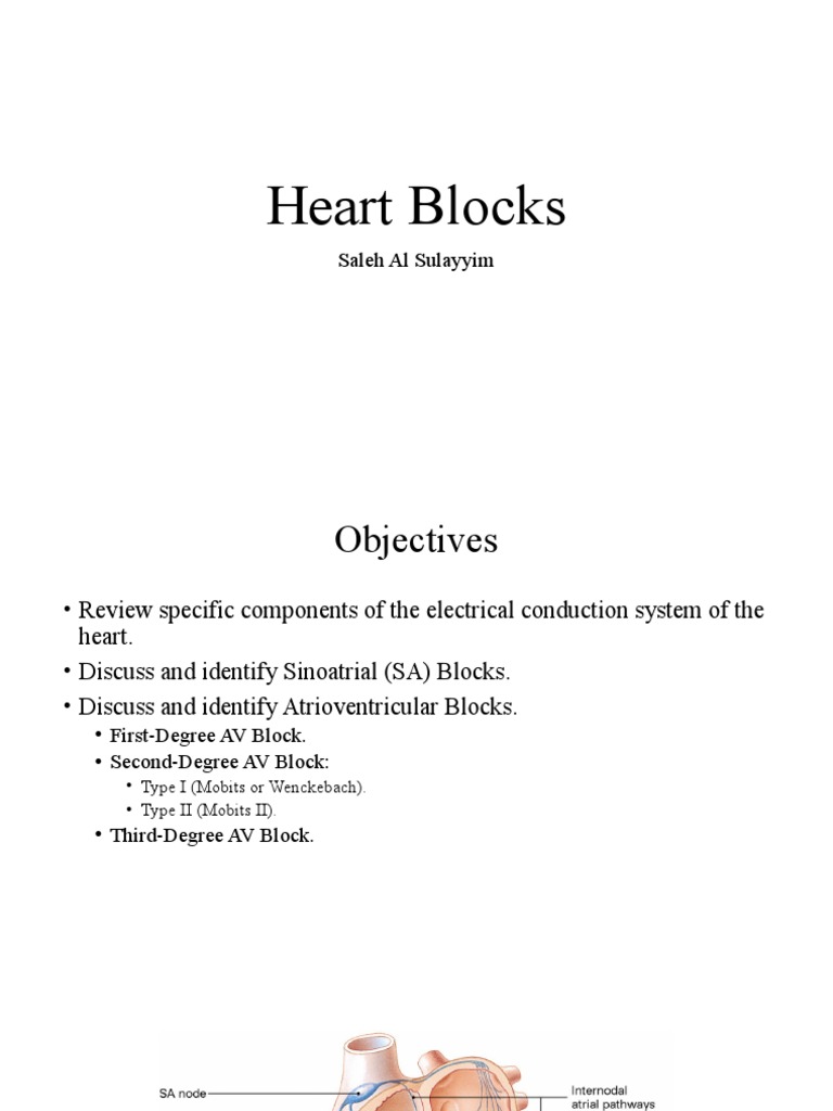 Heart Blocks | PDF | Cardiac Arrhythmia | Cardiology