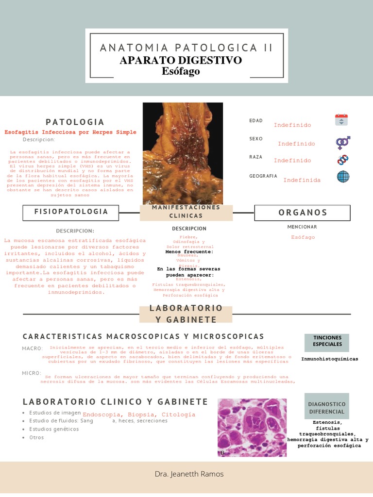 Esofagitis Infecciosa por VHS | PDF | Herpes Simple | Medicina