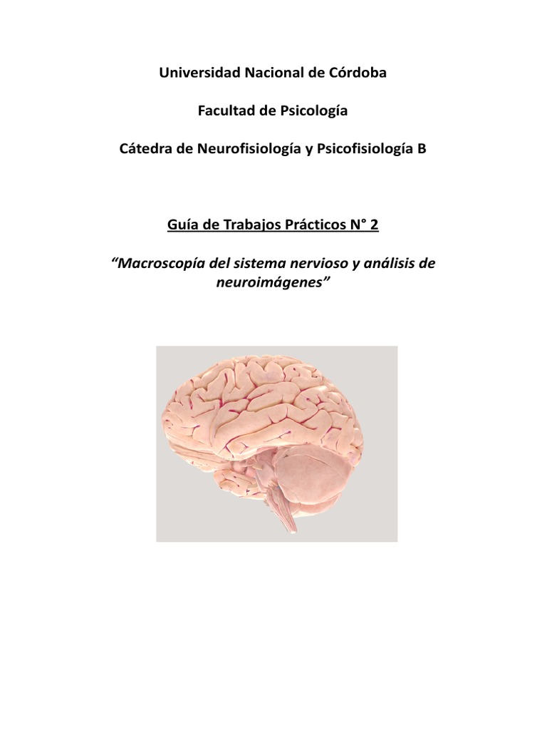 Guía Trabajo Práctico 2 - Macroscopía Del Sistema Nervioso y Análisis de Neuroimágenes | PDF ...