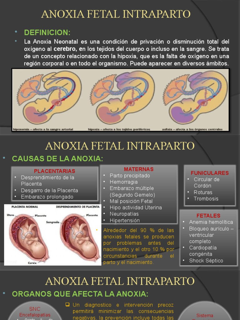 Anoxia Neonatal: Causas y Tratamiento | PDF | Feto | Parto