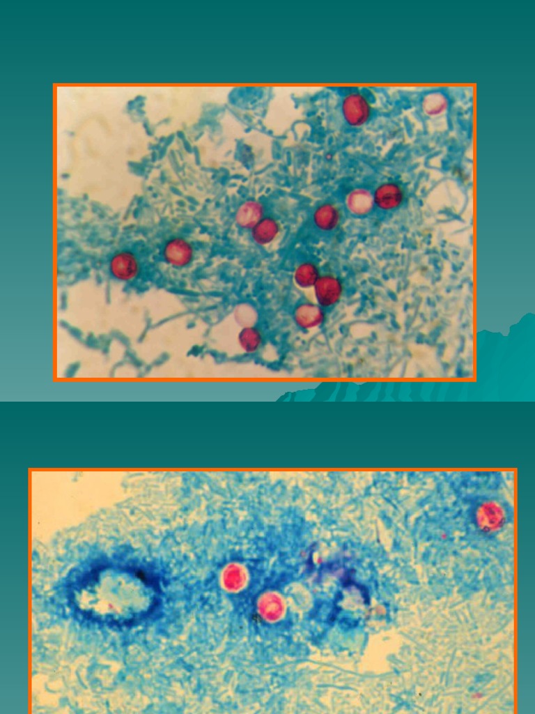 Coccidios intestinales | PDF