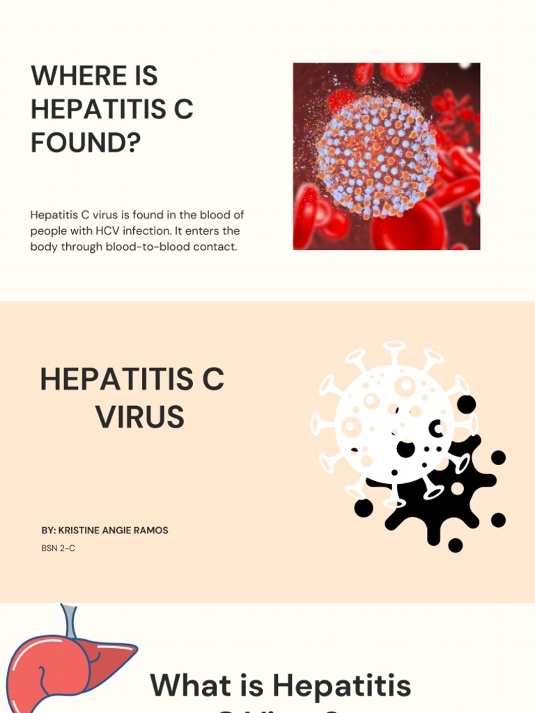 Ramos Kristine Angie BSN 2-C | PDF