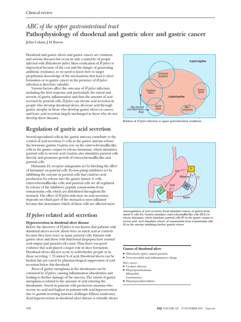 Pathophysiology of Duodenal and Gastric Ulcer and Gastric Cancer | PDF ...
