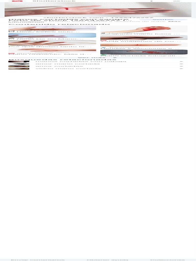 Cortadas en La Mano - Búsqueda de Google | PDF