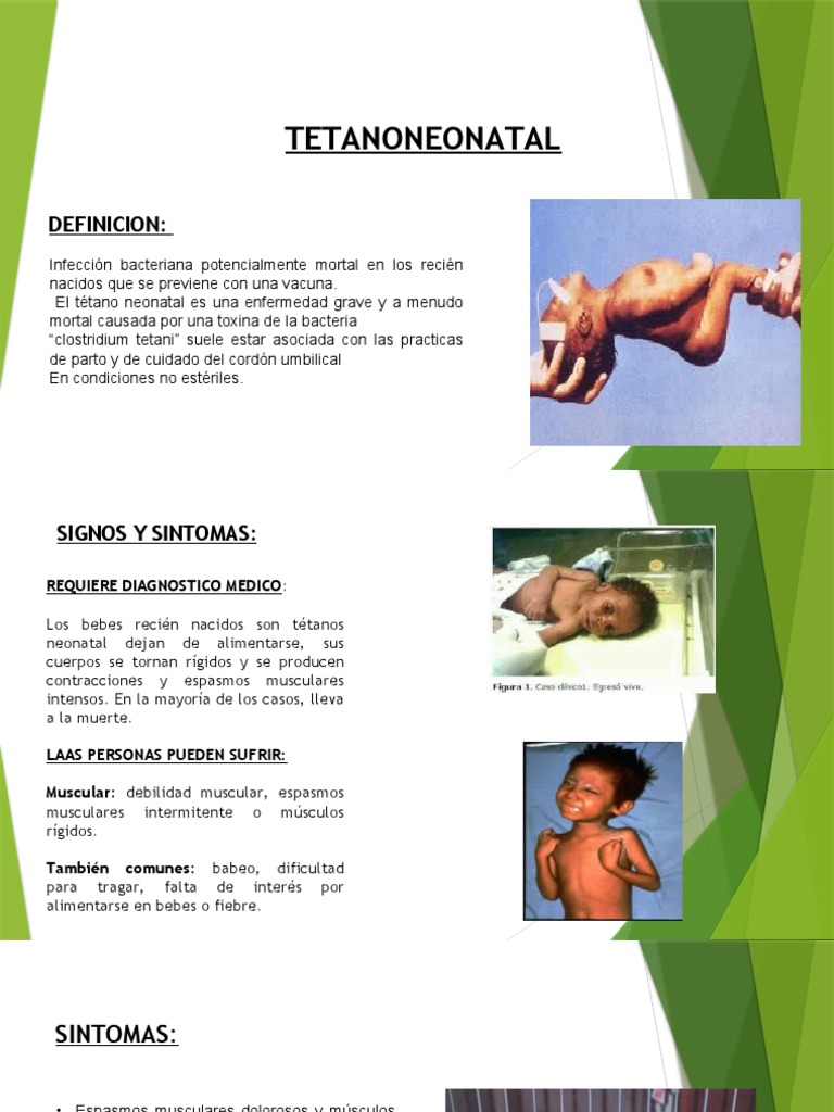 Tetano Neonatal (1) | PDF | Medicina CLINICA | Enfermedades y trastornos