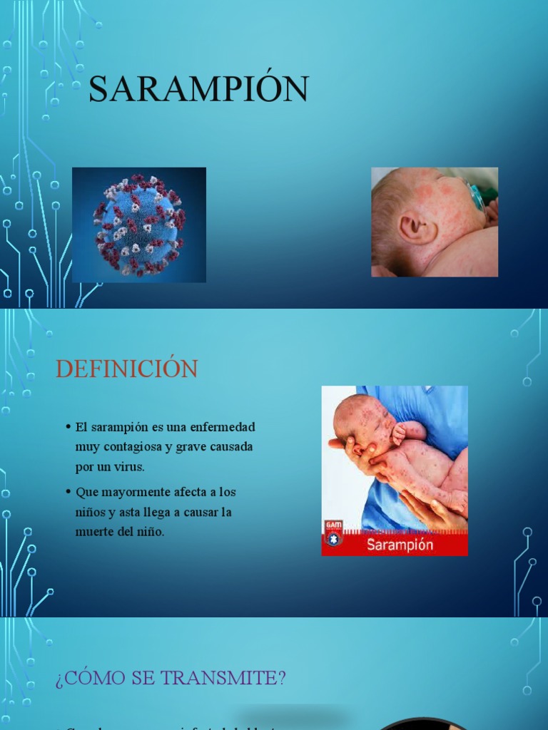 SARAMPION | PDF