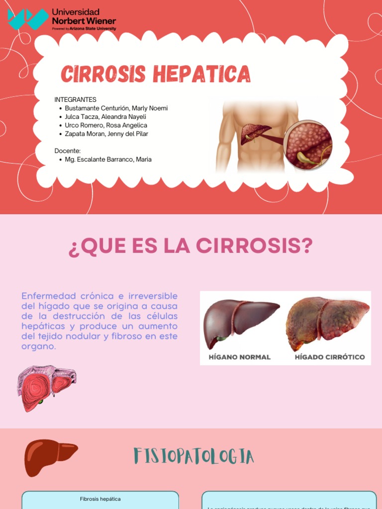 Cirrosis Hepatica | PDF