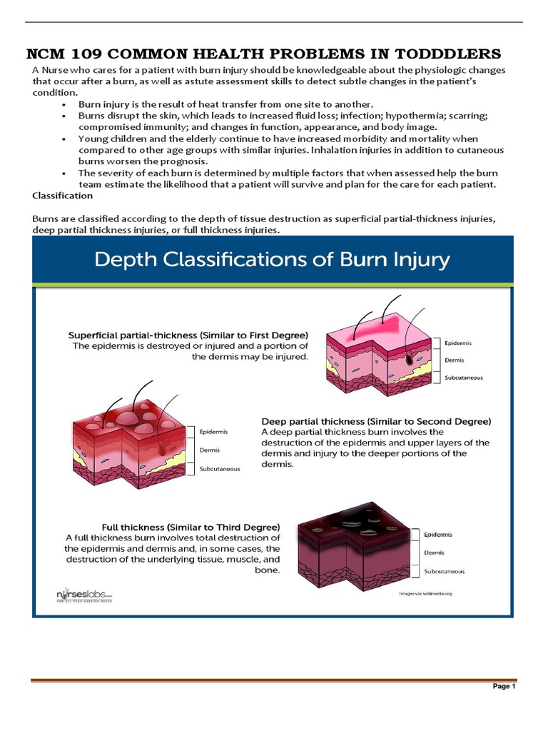 NCM 109 COMMON HEALTH PROBLEMS IN TODDDLERS | PDF | Burn | Injury