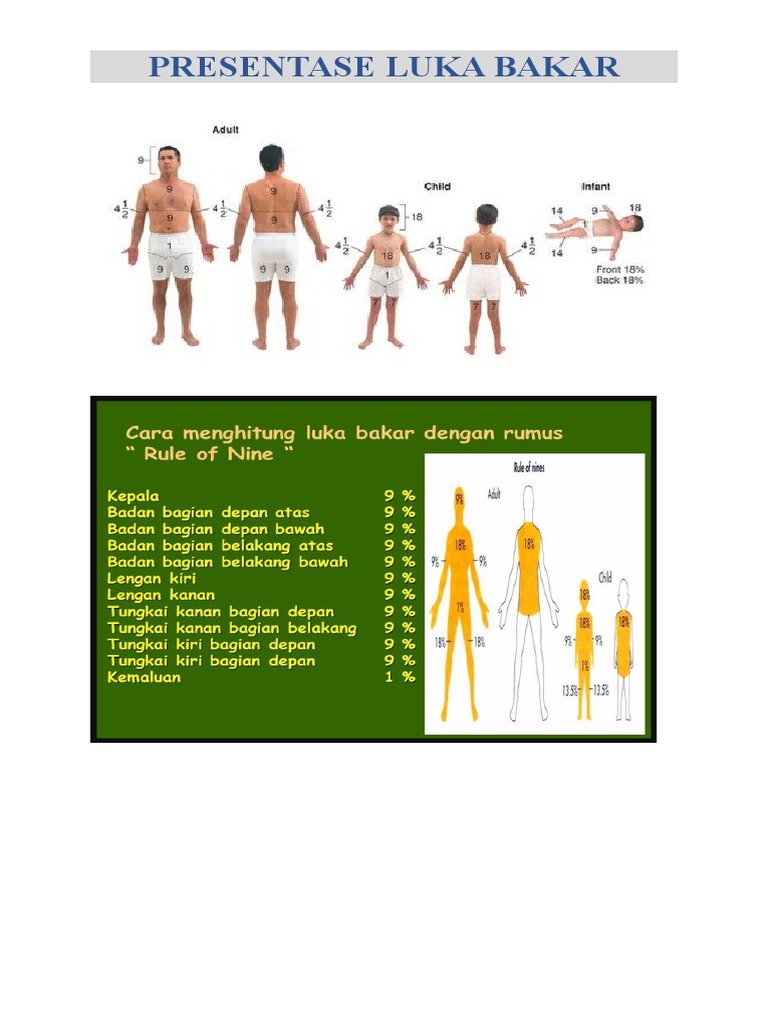Presentase Luka Bakar | PDF