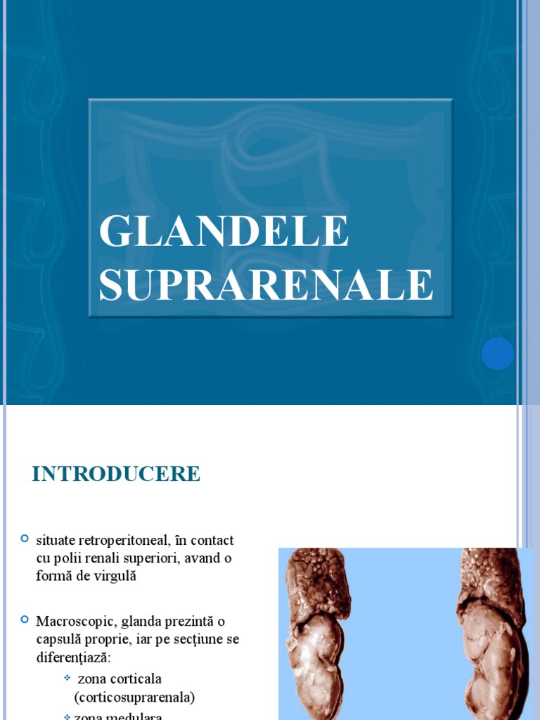 Vdocuments - MX Glandele Suprarenale 569c97d256197 | PDF