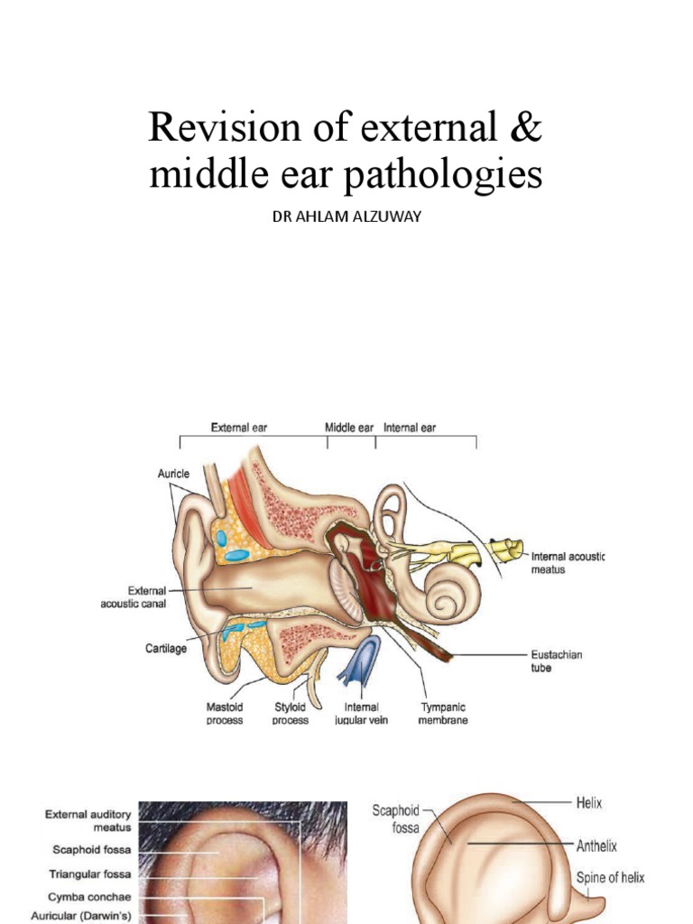Revesion of External and Middle Ear Pathologies | PDF | Ear | Health ...