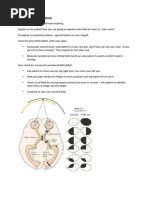 Confrontation Visual Fields - A Guide For Ophthalmologists in Training ...