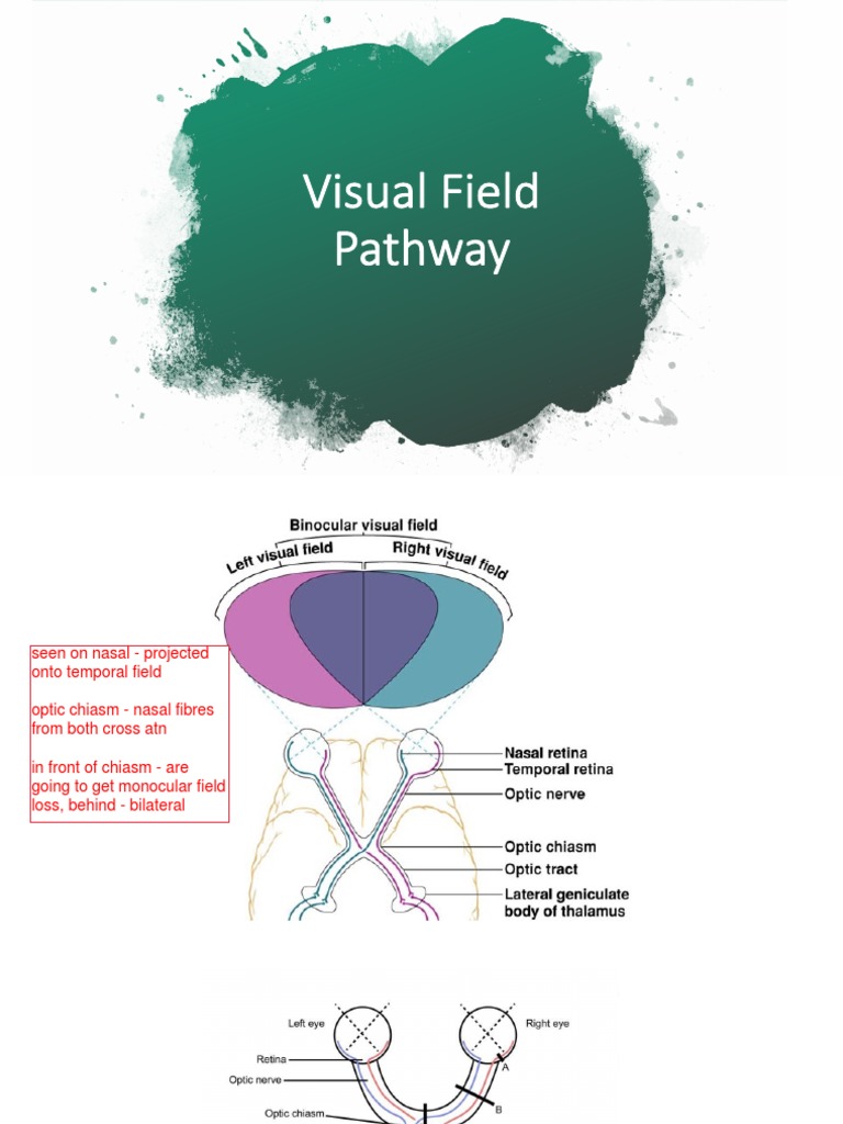 Optho Workshop One Visual Field Workshop | PDF