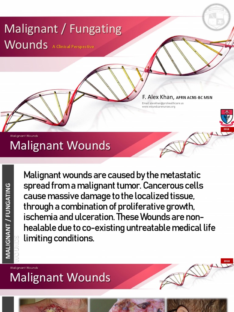 Malignant Wounds Clinical Perspective | PDF | Cancer | Wound