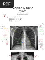 Cardiology Mnemonics for Key Concepts | PDF
