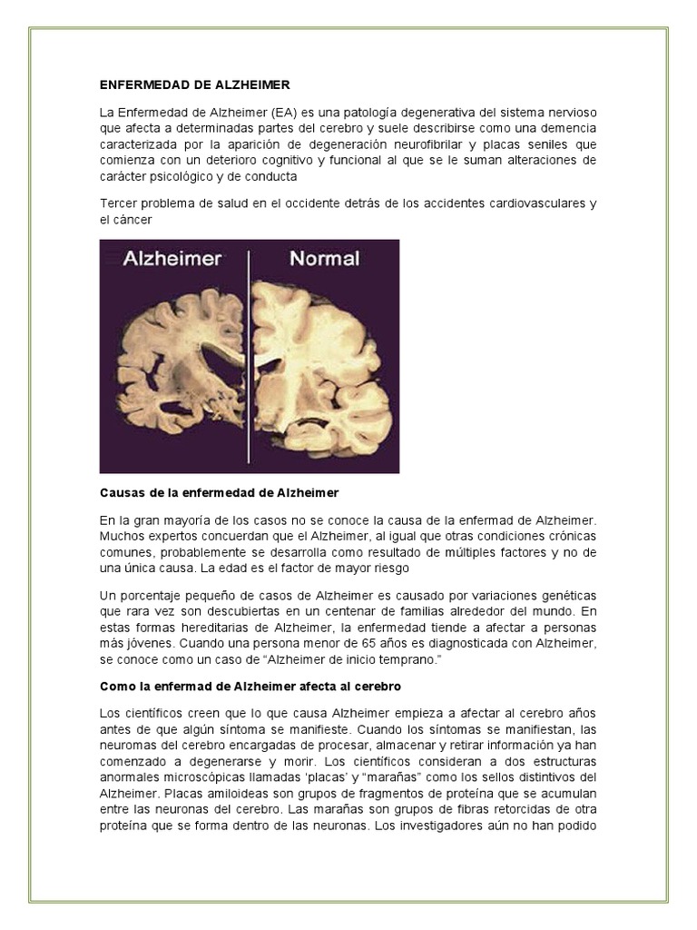 Entendiendo el Alzheimer: Causas y Efectos | PDF | Ciencia y matemáticas