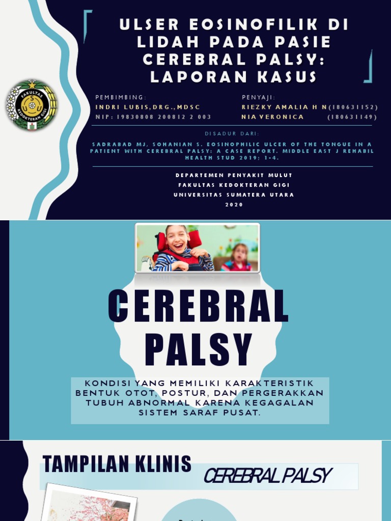 Ulser Eusinofilik Di Lidah Pada Pasien Cerebral Palsy | PDF