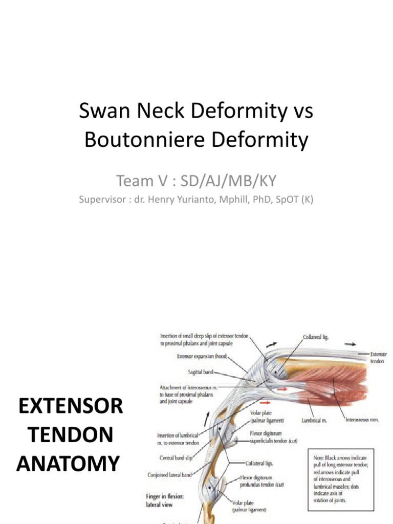 12 Oktober 2017 - Swan Neck Deformity Vs Boutonniere | PDF ...