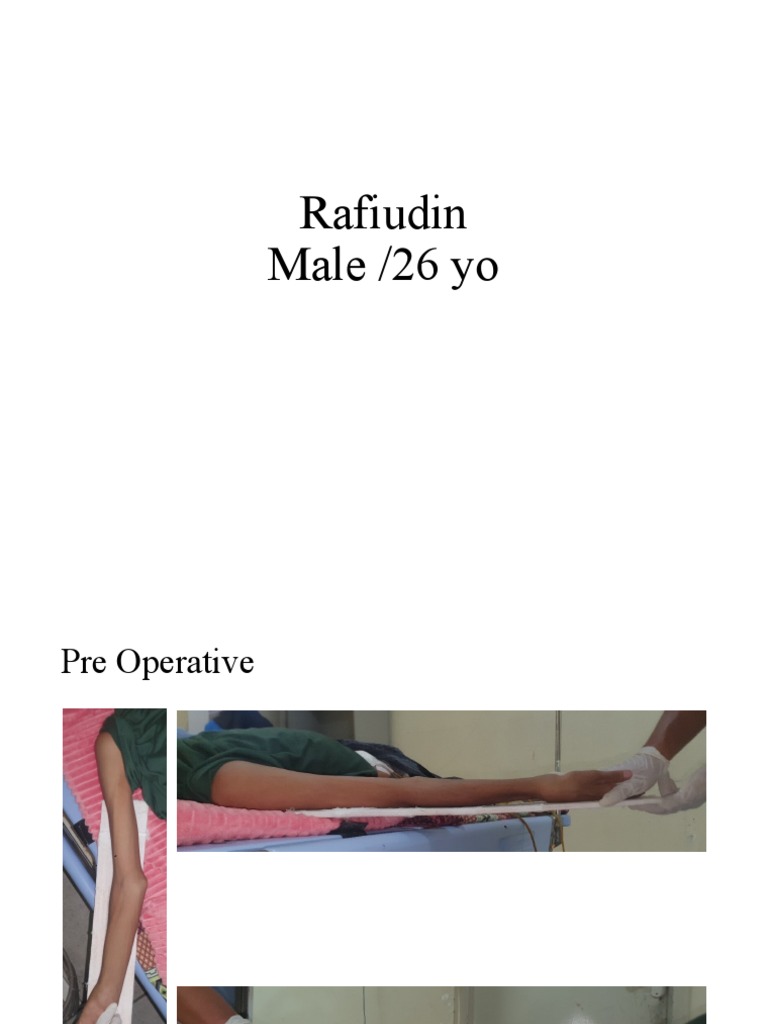 Post Op Hand Rafiuddin BN | PDF
