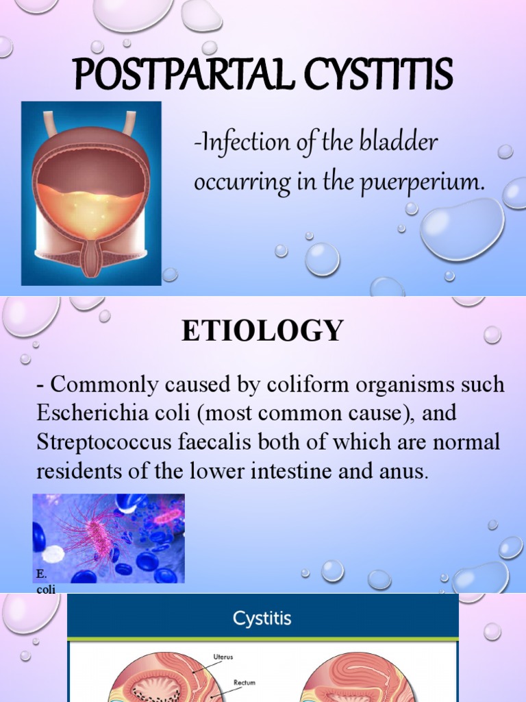 Spartal Cystits | PDF