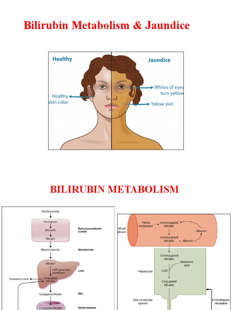 32 Jaundice, VanD RXN and Bilirubin Metabolism | PDF