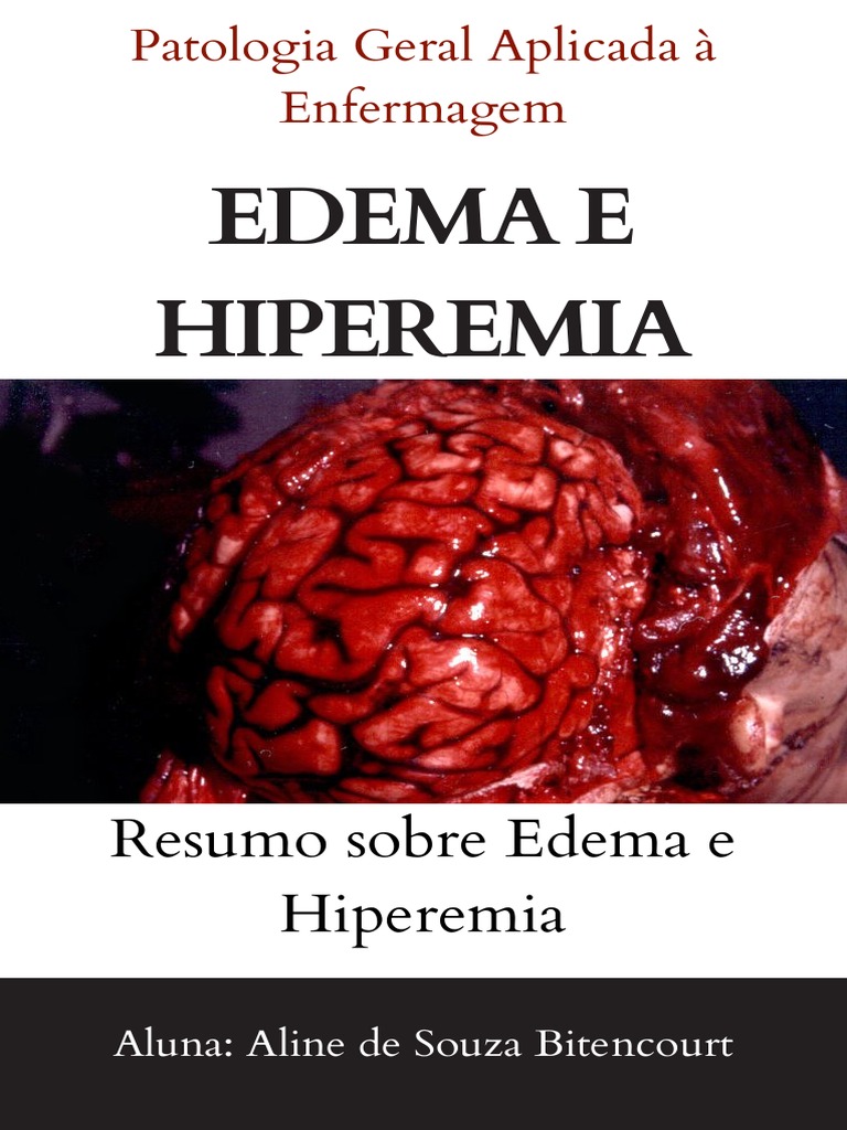 Resumo sobre Edema e Hiperemia - Patologia Geral Aplicada à Enfermagem ...