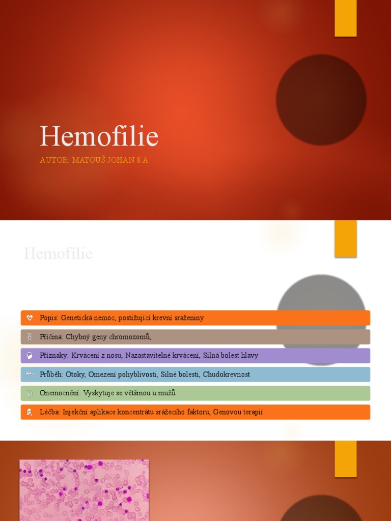 Hemofilie | PDF