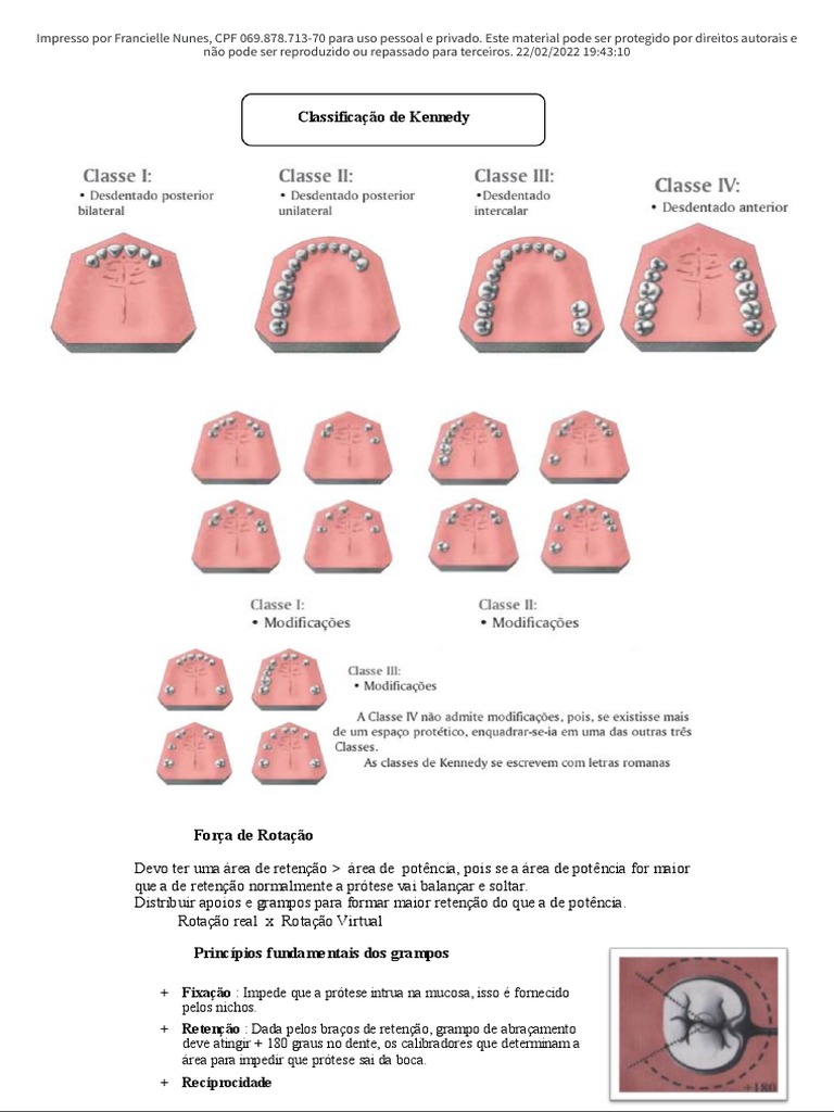 Prótese Parcial Removível - Passei Direto | PDF | Dente | Boca
