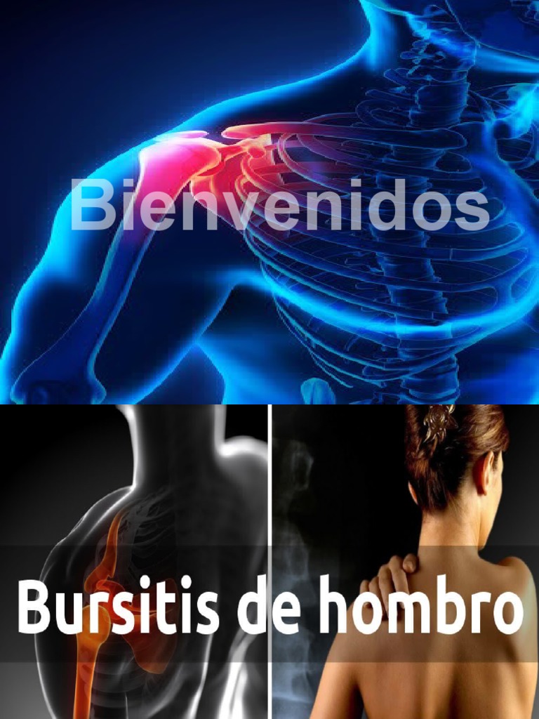 Bursitis en Hombro | Descargar gratis PDF | Hombro | Terapia física