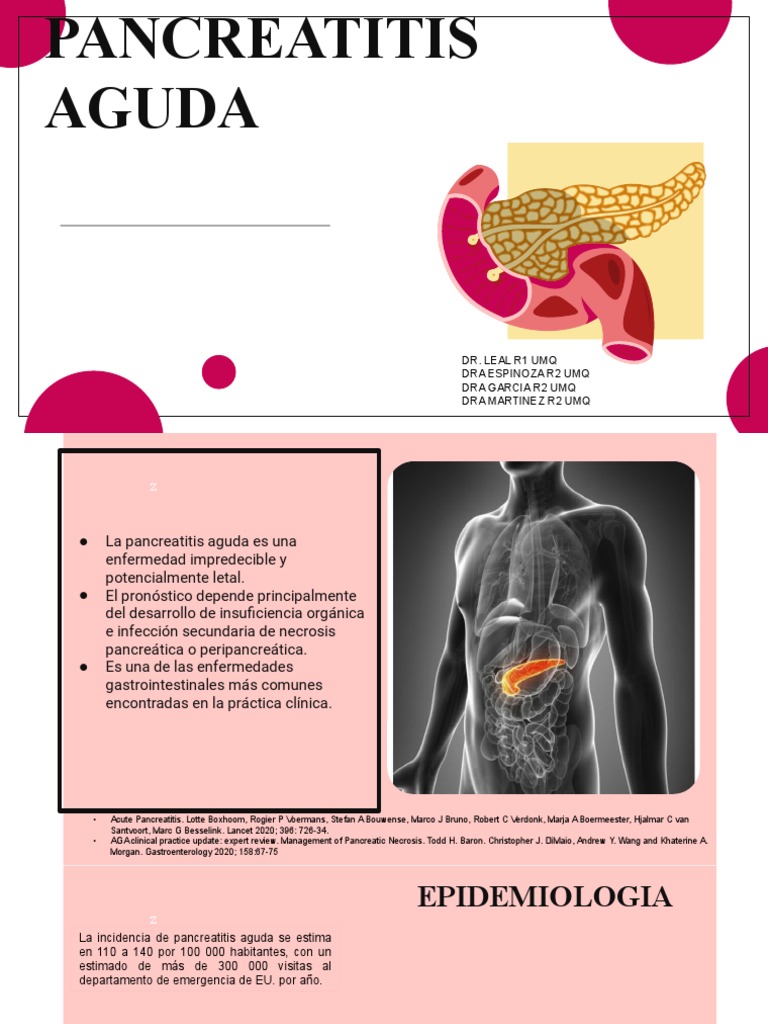 Pancreatitis Aguda: Guía Clínica | PDF | Inflamación | Causas de la muerte