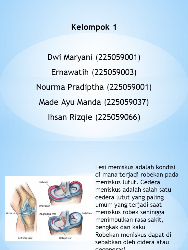 Cedera Meniskus dan Tenosynovitis Radial | PDF | Griya & Taman