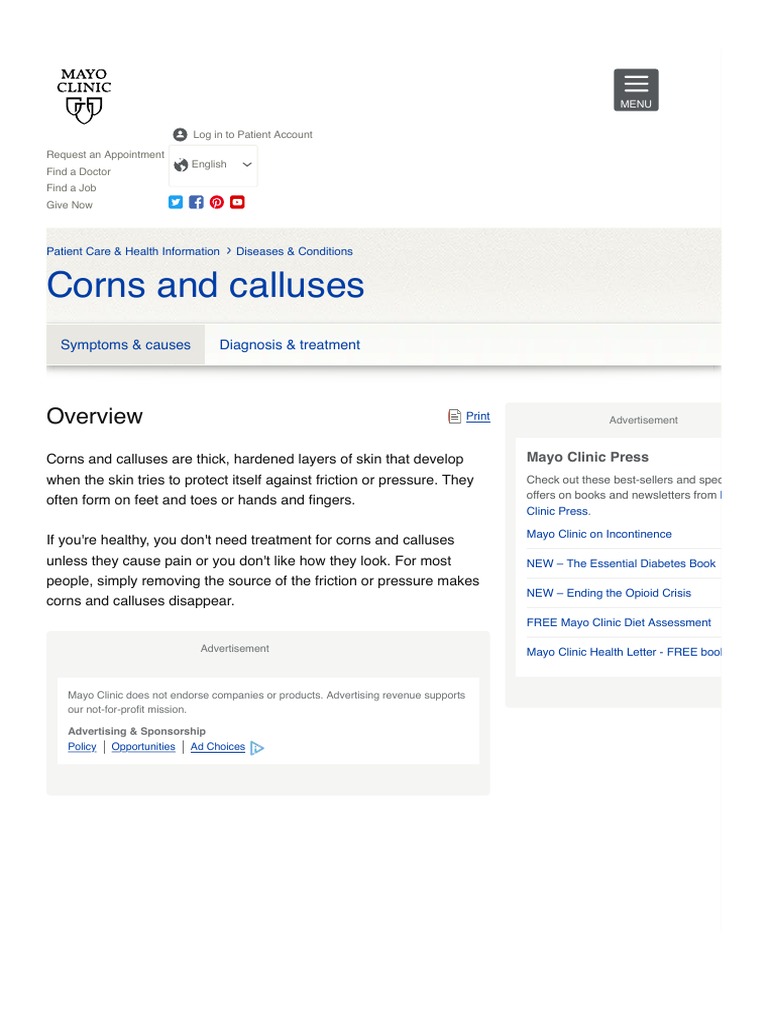 Corns and Calluses - Symptoms and Causes - Mayo Clinic | PDF | Shoe ...
