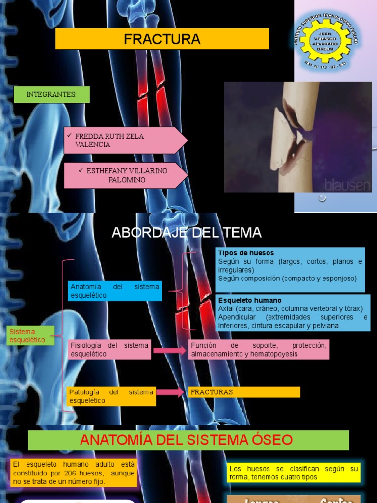 Fractura | PDF | Hueso | Esqueleto