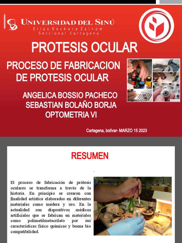 EXPOSICION Actual DE PROTESIS OCULAR ANGELICA Y SEBAS | PDF ...