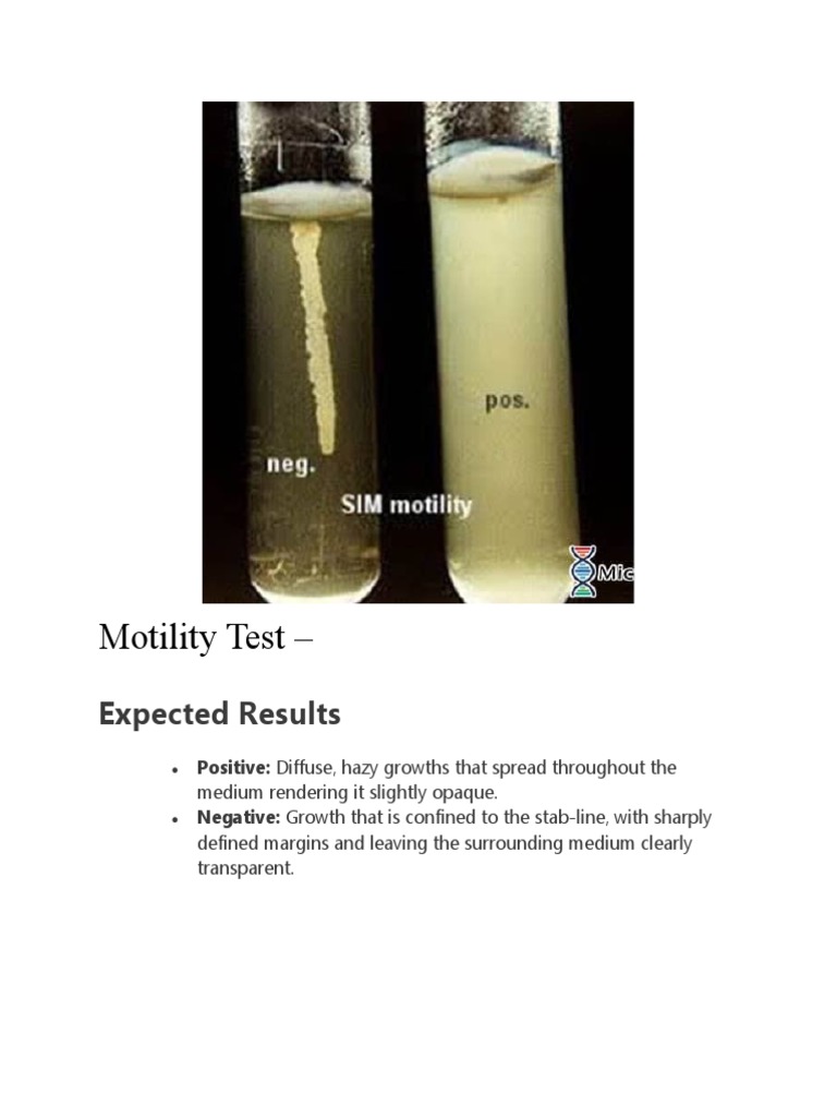 MOTILITY | PDF | Bacteria | Agar