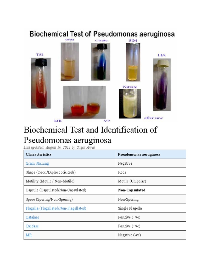 Biochemical Test and Identification of Pseudomonas Aeruginosa | PDF ...