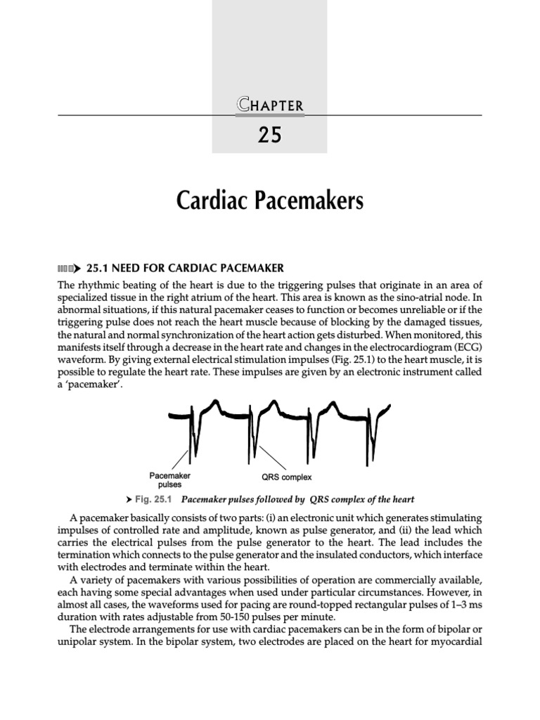 Pacemaker And Types Pdf Artificial Cardiac Pacemaker