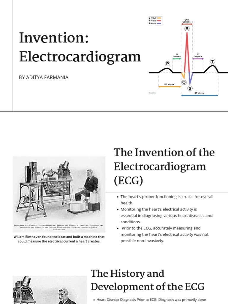 History and Advances in ECG Technology | PDF | Electrocardiography | Heart