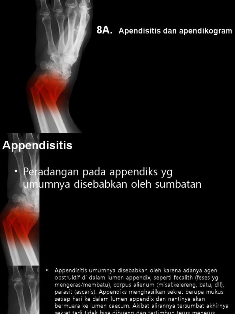 Diagnosa Apendisitis dan Appendicogram | PDF