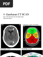 Gans Sensory Organization Performance (SOP) Test | PDF | Vertigo ...