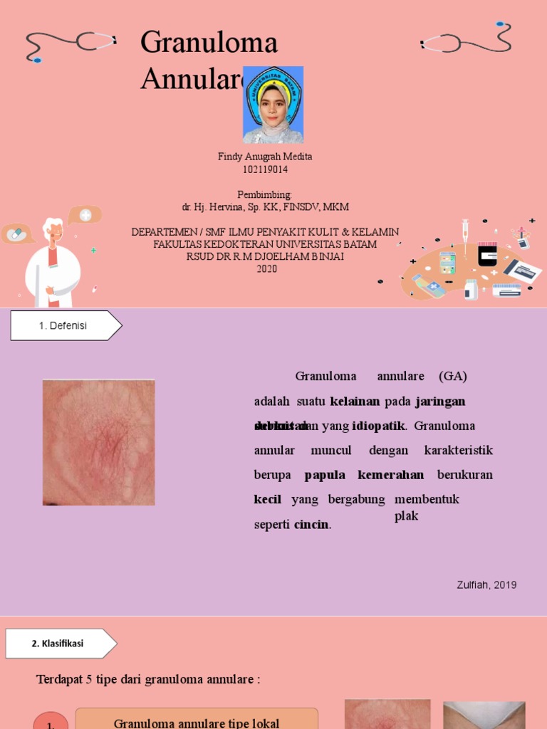 Granuloma Annulare: Definisi dan Terapi | PDF