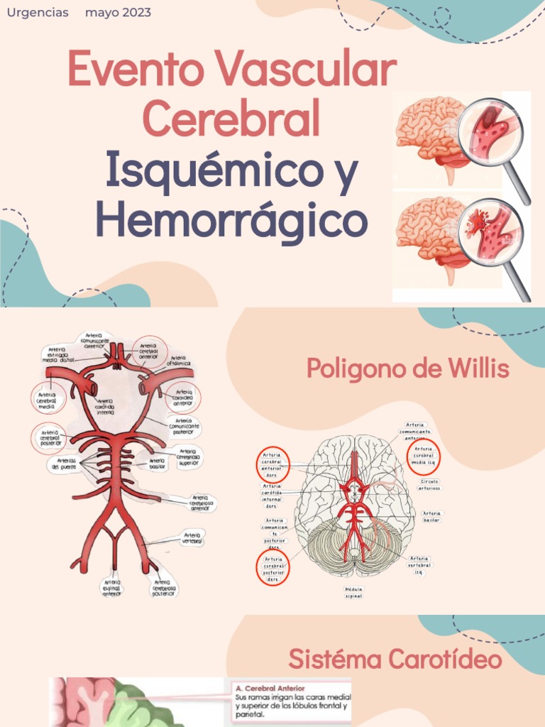 EVC: Isquémico y Hemorrágico Urgente | PDF | Carrera | Isquemia