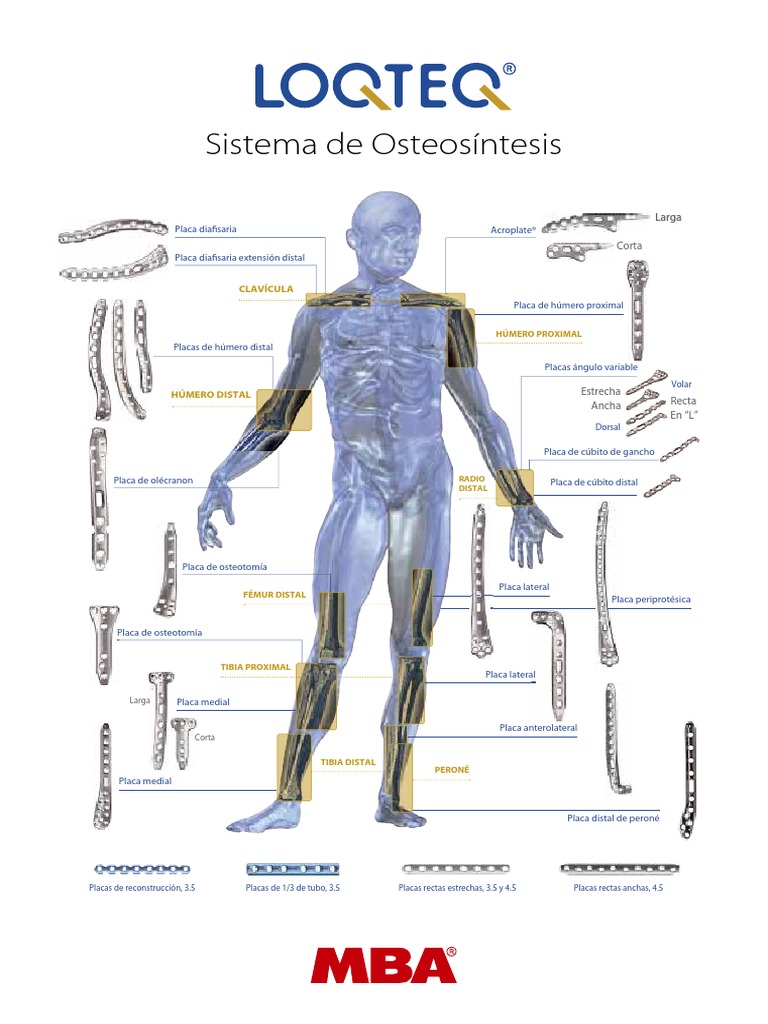 Sistema de Osteosintesis | PDF | Tornillo | Hueso