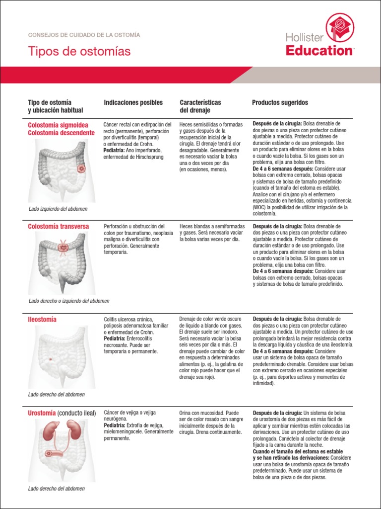 Tipos de Ostomias | PDF