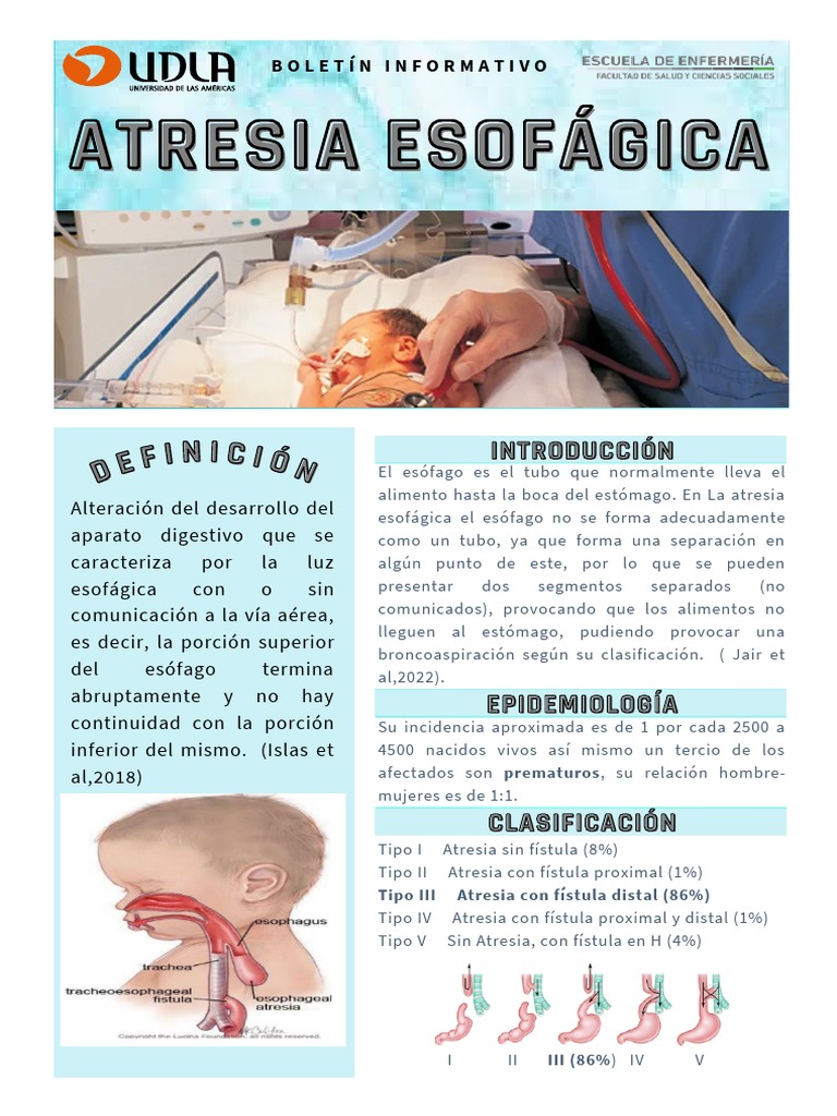 Atresia Esofágica | PDF | Enfermedades y trastornos | Medicina CLINICA