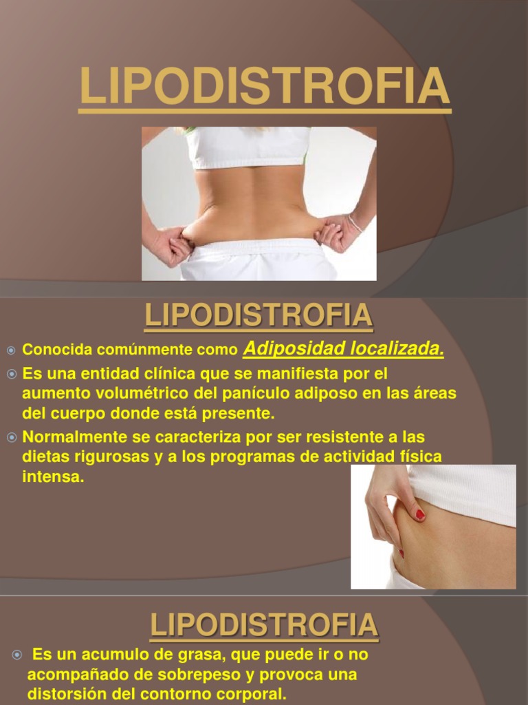 Lipodistrofia | PDF | Tejido adiposo | Medicina CLINICA