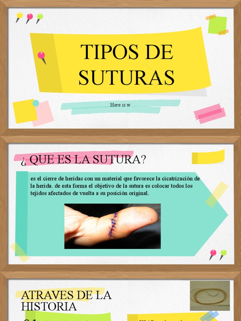 Tipos de Suturas. | PDF