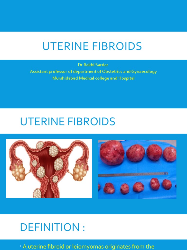 Uterine Fibroids | PDF | Gynaecology | Human Reproduction