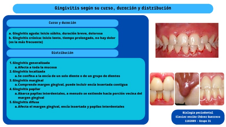 Tipos de Gingivitis y su Clasificación | PDF