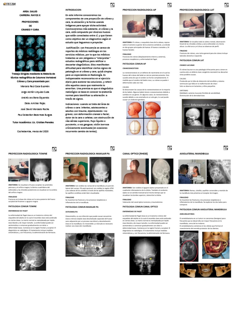 Triptico Final (1) .... | PDF | Hueso | Cráneo
